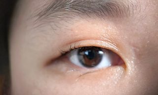 Double Eyelids vs. Monolids vs. Hooded Eyes: Key Differences